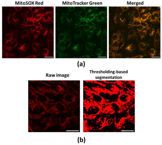 Differential Mitochondrial, Oxidative Stress and Inflammatory Responses ...