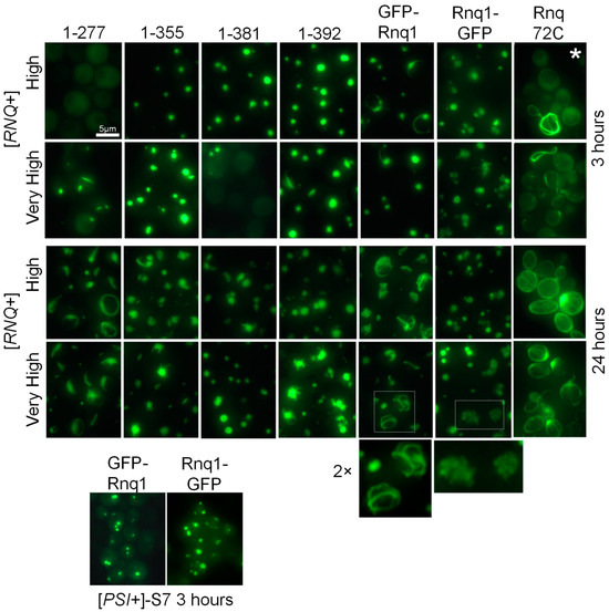 IJMS | Free Full-Text | Mapping of Prion Structures in the Yeast Rnq1