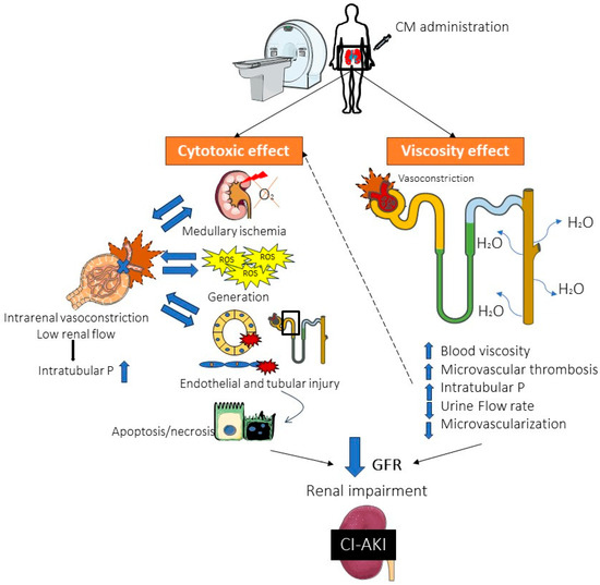 Biomarkers in Contrast-Induced Acute Kidney Injury: Towards A New ...