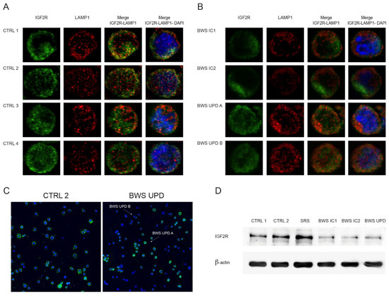 Dysfunction in IGF2R Pathway and Associated Perturbations in Autophagy ...