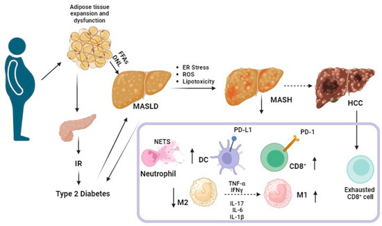 IJMS | Free Full-Text | The PD-1/PD-L1 Axis in the Biology of MASLD