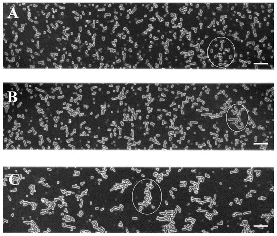 Assessment of Red Blood Cell Aggregation in Preeclampsia by ...