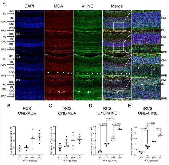 Unveiling Drivers of Retinal Degeneration in RCS Rats: Functional ...