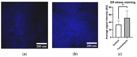 IJMS | Free Full-Text | Endoplasmic Reticulum Stress Induces ...