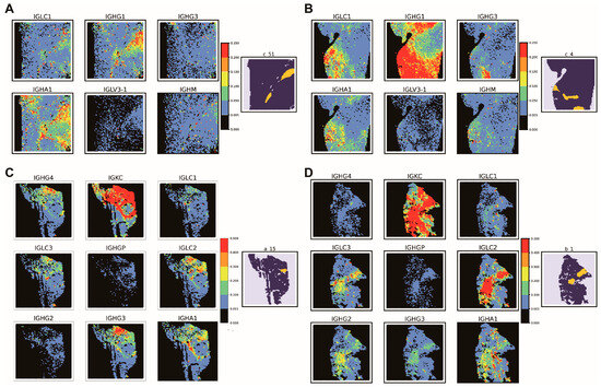 Machine Learning-Based Characterization and Identification of Tertiary Lymphoid Structures Using ...