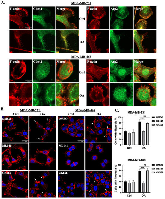 Oleate Promotes Triple-Negative Breast Cancer Cell Migration by ...