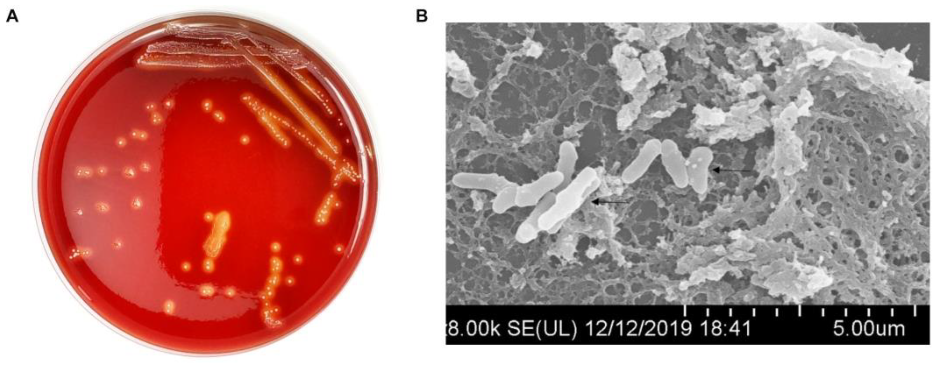 Phenotypic Characteristics, Antimicrobial Susceptibility and Virulence ...