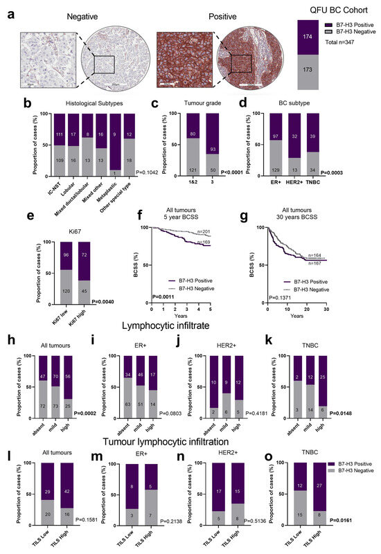B7-H3 Expression in Breast Cancer and Brain Metastasis