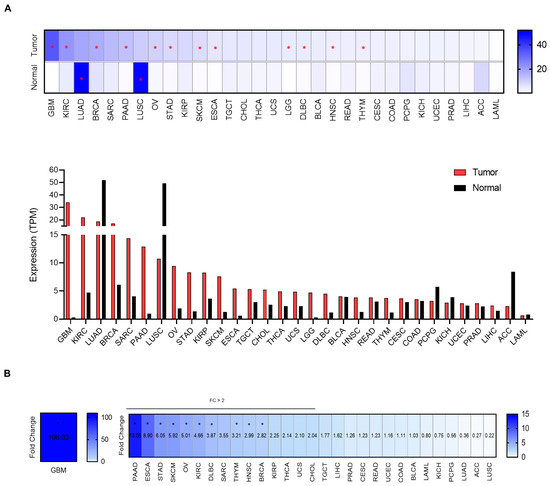 In Silico Transcriptomic Expression of MSR1 in Solid Tumors Is ...
