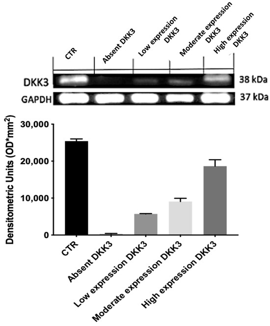 DKK3 Expression in Glioblastoma: Correlations with Biomolecular Markers