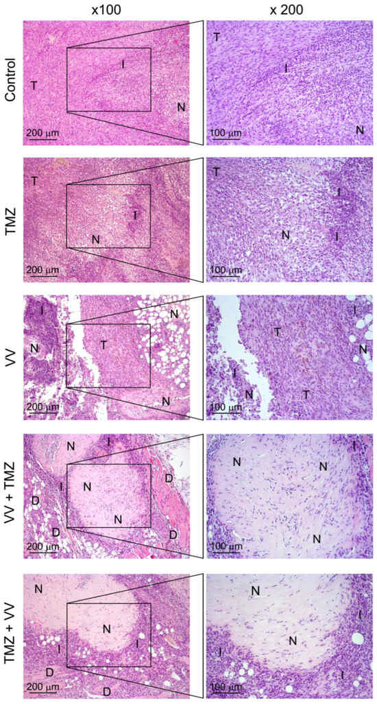 The Recombinant Oncolytic Virus VV-GMCSF-Lact and Chemotherapy Drugs ...