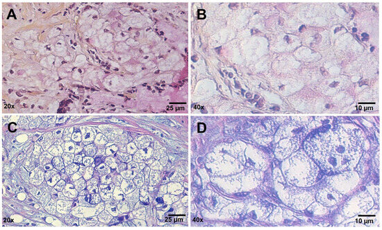 Novel Ultrastructural Insights into the Clear-Cell Carcinoma of the ...