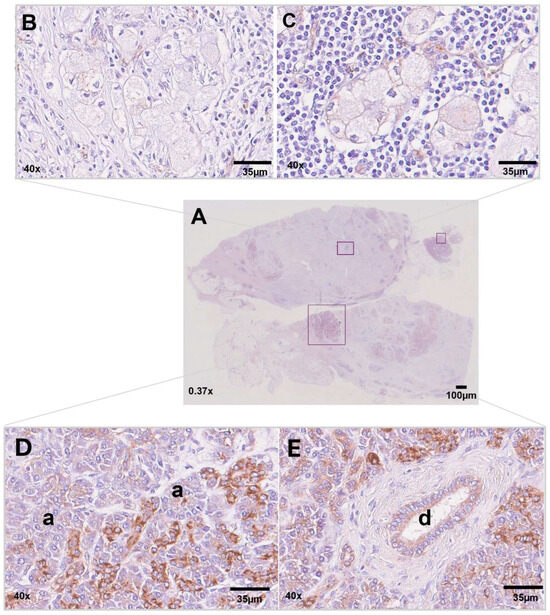 Novel Ultrastructural Insights into the Clear-Cell Carcinoma of the ...