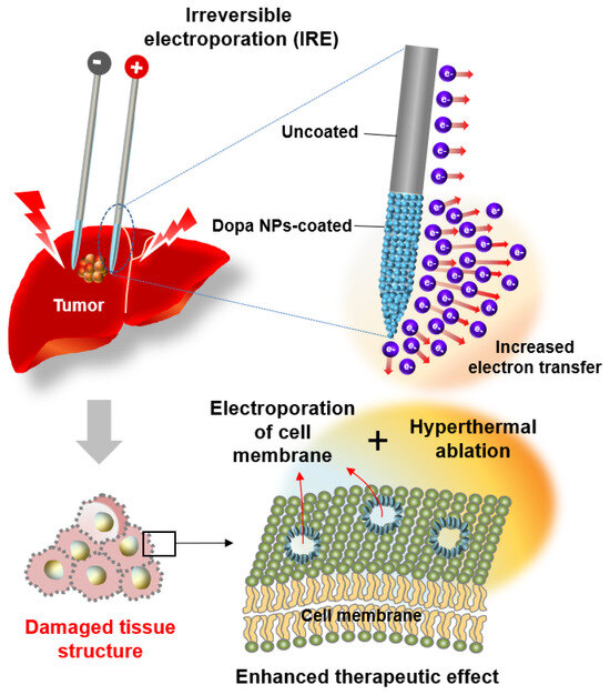 The Induction of Combined Hyperthermal Ablation Effect of Irreversible ...