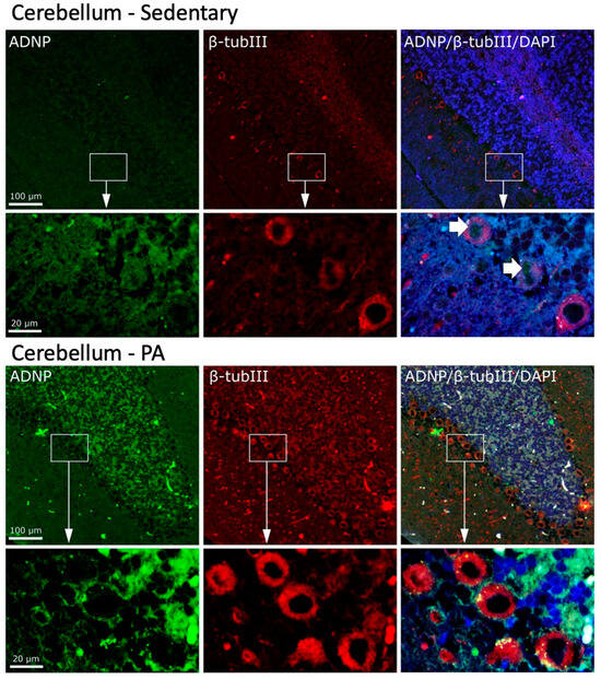 Moderate Physical Activity Increases the Expression of ADNP in Rat Brain