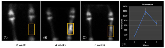 Reconstruction of Segmental Bone Defect in Canine Tibia Model Utilizing Bi-Phasic Scaffold ...