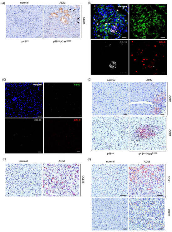Cytokine CCL9 Mediates Oncogenic KRAS-Induced Pancreatic Acinar-to ...