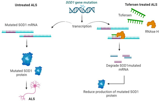 Antisense Oligonucleotides (ASOs) in Motor Neuron Diseases: A Road to ...