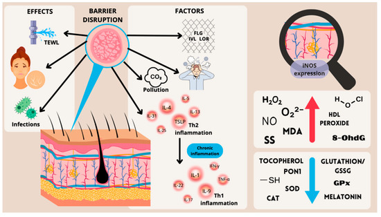 IJMS | Free Full-Text | An Overview on Atopic Dermatitis, Oxidative ...