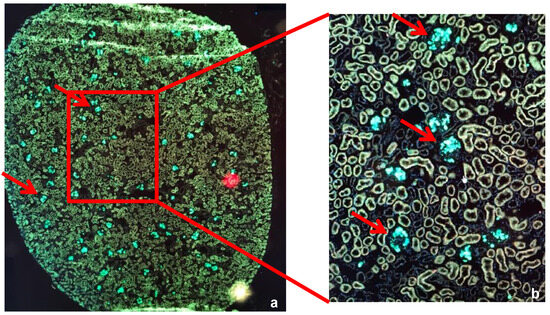 Delivery of Mesenchymal Stem Cells during Hypothermic Machine Perfusion ...