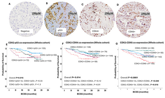 Clinicopathological Significance of Cyclin-Dependent Kinase 2 (CDK2) in ...
