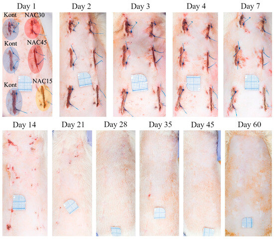 Pre-Incisional and Multiple Intradermal Injection of N-Acetylcysteine ...