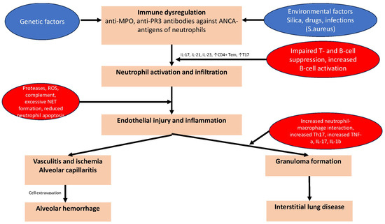 Pathogenesis of Pulmonary Manifestations in ANCA-Associated Vasculitis ...