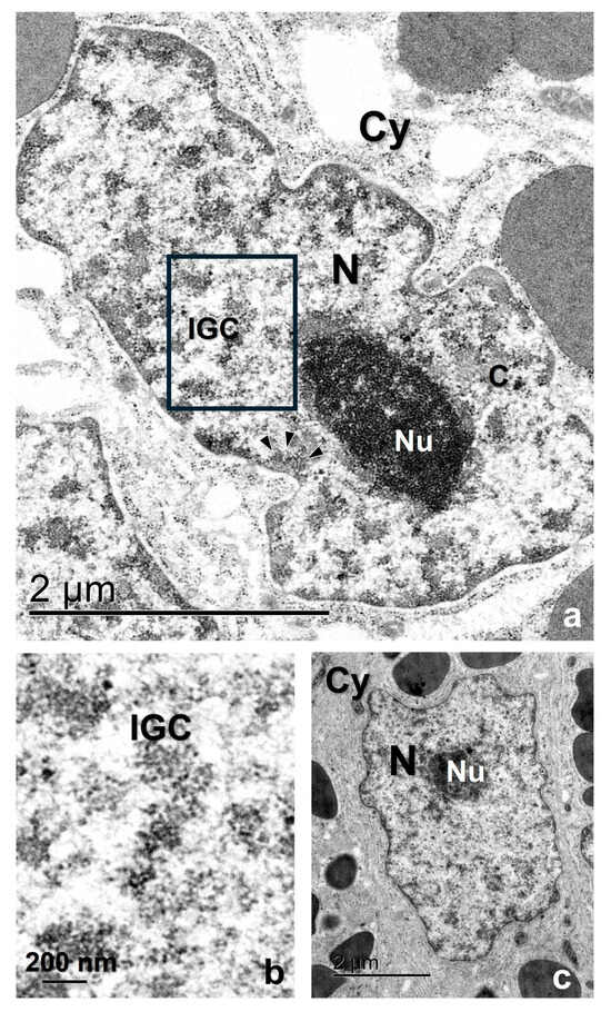 Microscopic Analysis of Nuclear Speckles in a Viviparous Reptile