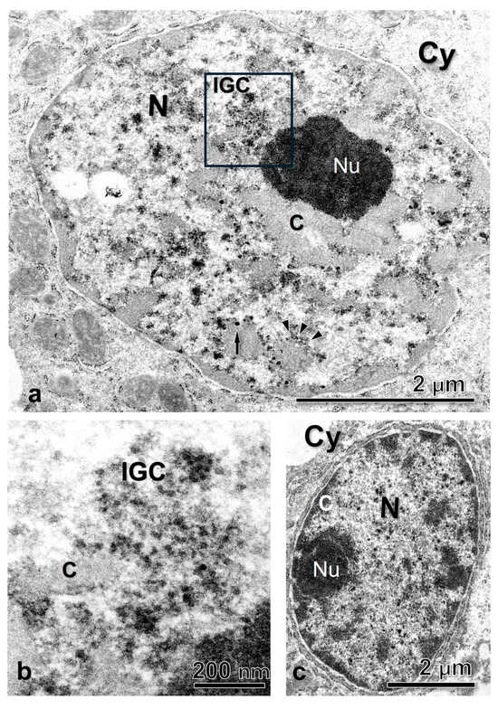 Microscopic Analysis of Nuclear Speckles in a Viviparous Reptile