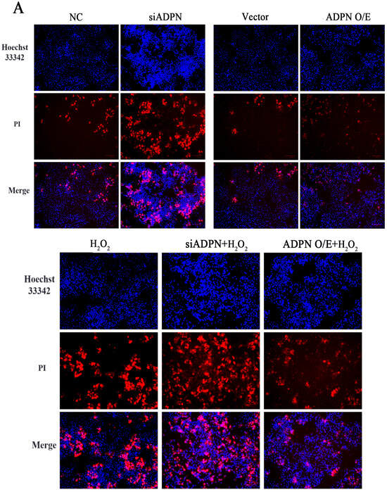 ADPN Regulates Oxidative Stress-Induced Follicular Atresia in Geese by ...