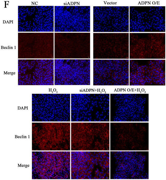 ADPN Regulates Oxidative Stress-Induced Follicular Atresia in Geese by ...