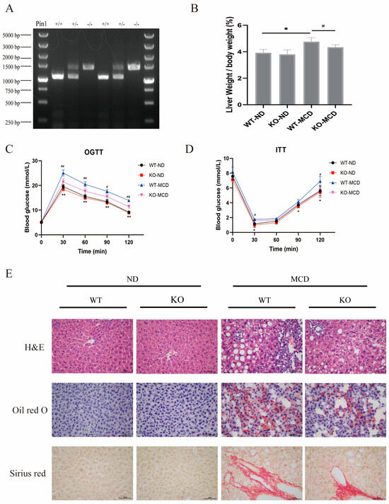 IJMS | Free Full-Text | Pin1 Exacerbates Non-Alcoholic Fatty Liver ...