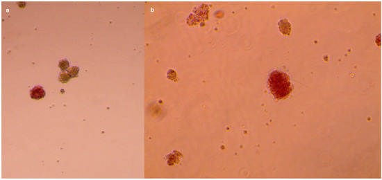IJMS | Free Full-Text | Advancing Diabetes Research: A Novel Islet ...
