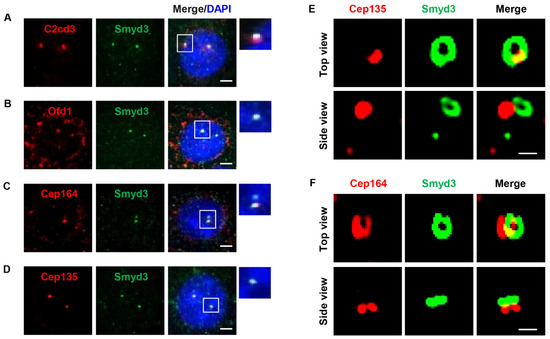 SMYD3 Controls Ciliogenesis by Regulating Distinct Centrosomal Proteins ...