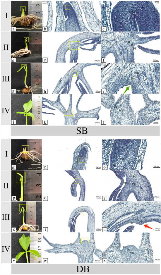IJMS | Free Full-Text | Endogenous Hormone Levels and Transcriptomic ...