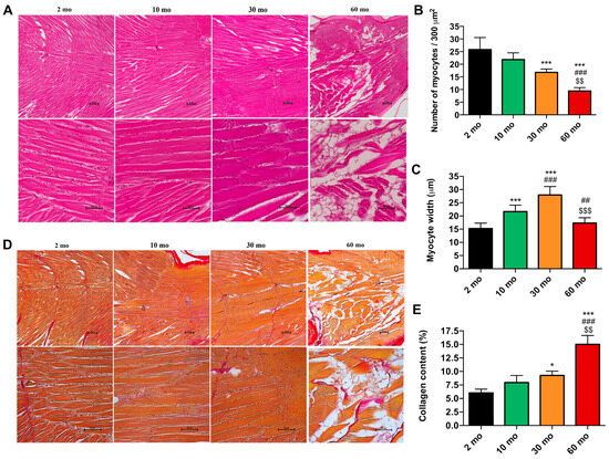 Zebrafish as a Human Muscle Model for Studying Age-Dependent Sarcopenia ...