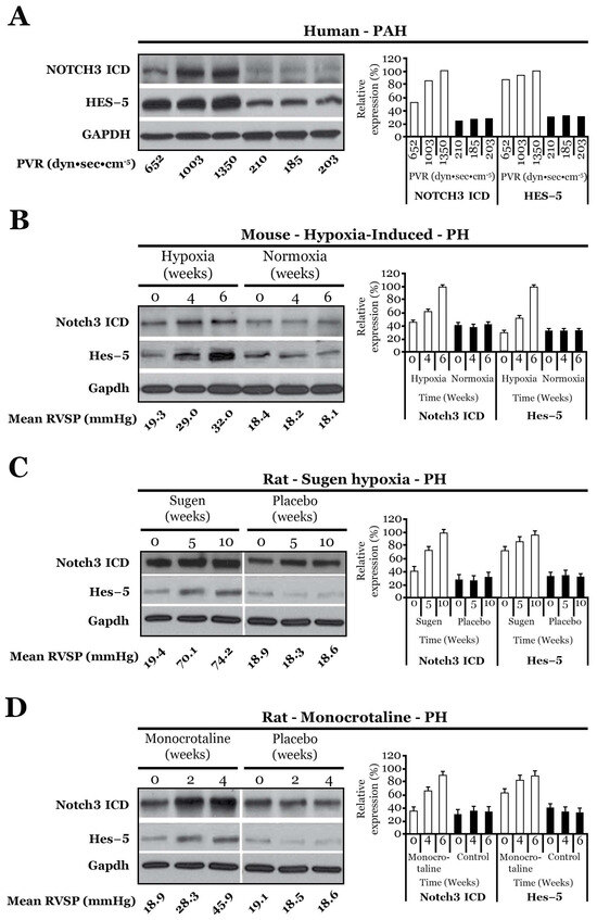 NOTCH3 and Pulmonary Arterial Hypertension