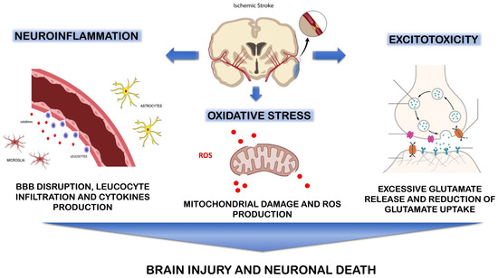 IJMS | Free Full-Text | Molecular Pathogenesis of Ischemic and ...
