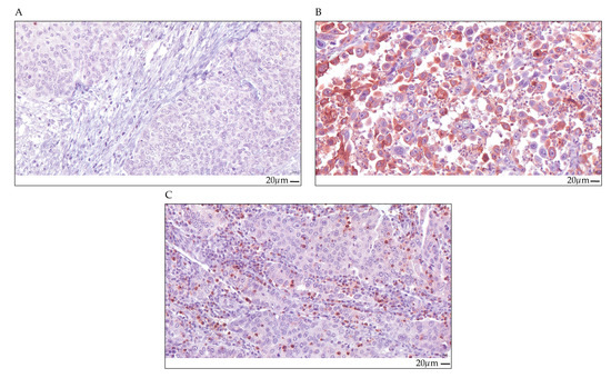 Prognostic and Predictive Potential of CCL5 Expression in Muscle ...