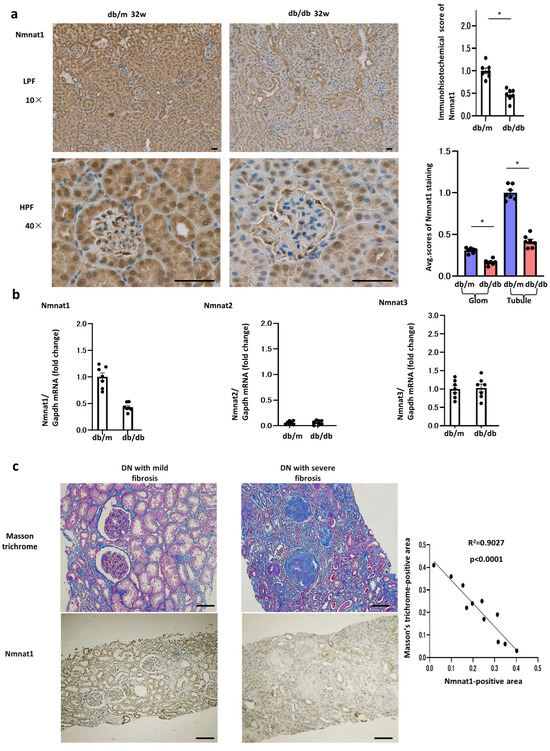 Nmnat1 Deficiency Causes Mitoribosome Excess in Diabetic Nephropathy ...