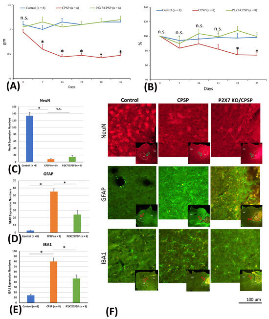 The P2X7 Hypothesis of Central Post-Stroke Pain