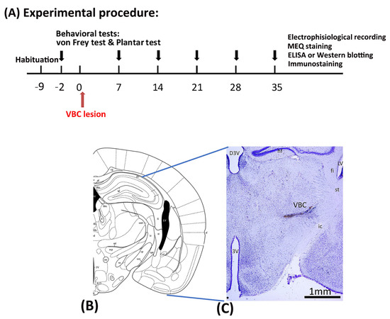 The P2X7 Hypothesis of Central Post-Stroke Pain