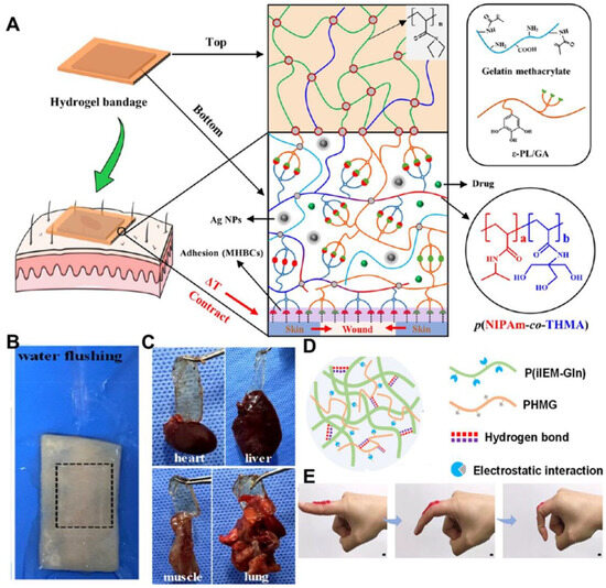 Hydrogel Wound Dressings Accelerating Healing Process of Wounds in Movable Parts