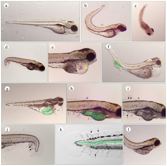 Urtica dioica Extract Abrogates Chlorpyrifos-Induced Toxicity in ...