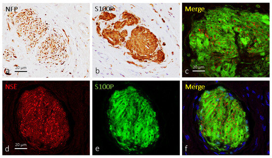 Axonal and Glial PIEZO1 and PIEZO2 Immunoreactivity in Human Clitoral ...