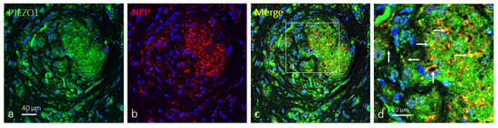 Axonal and Glial PIEZO1 and PIEZO2 Immunoreactivity in Human Clitoral ...