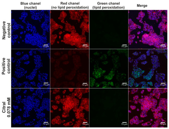 Expanding Knowledge about the Influence of Citral on Cognitive ...