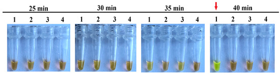 A Novel Multiplex LAMP Assay for the Detection of Respiratory Human ...