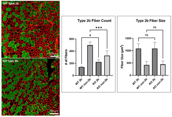 Skeletal Muscle UCHL1 Negatively Regulates Muscle Development and ...