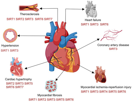 Exploring Sirtuins: New Frontiers in Managing Heart Failure with ...